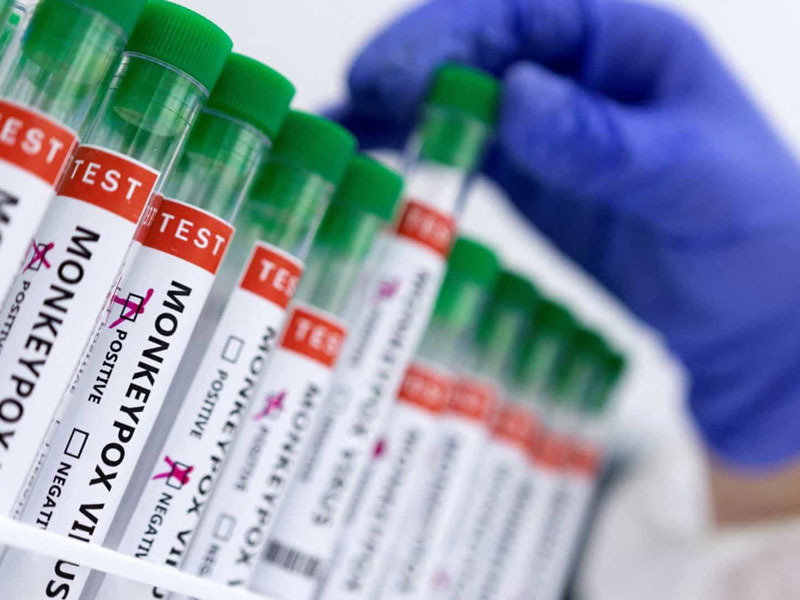 Laboratório da FMABC é credenciado para rede estadual de testes da ... Laboratório da FMABC é credenciado para rede estadual de testes da ...